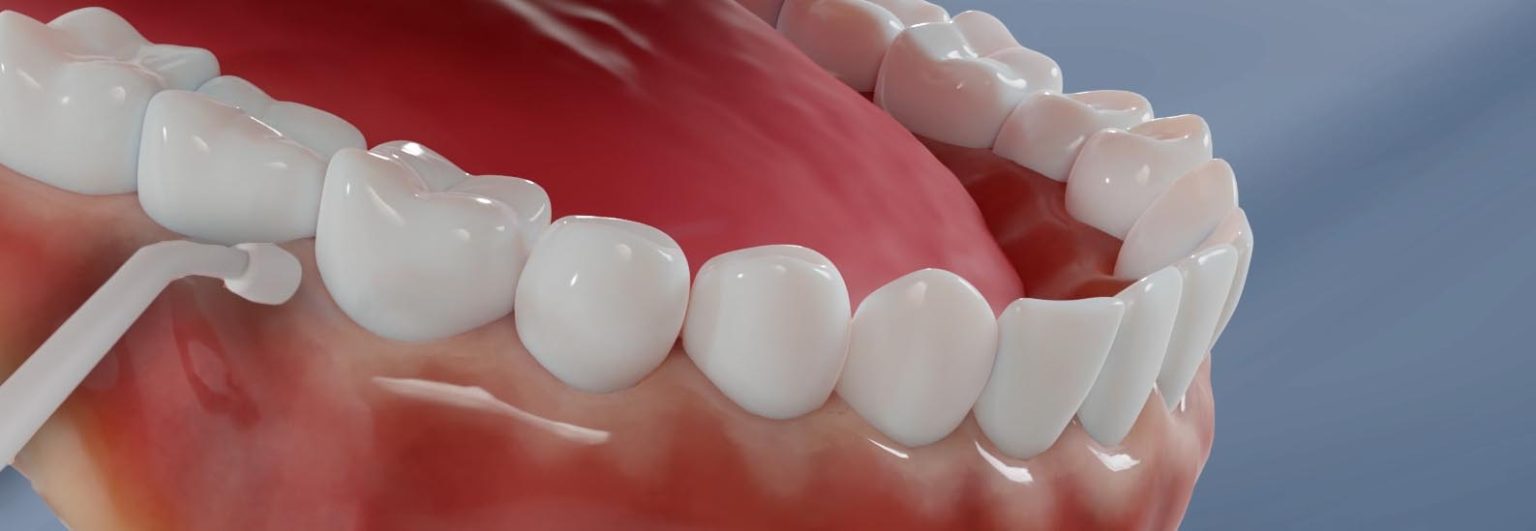 Beyond Brushing: How to Floss with Proper Technique - Copeland Family ...